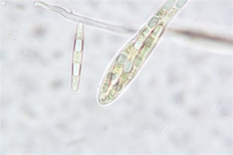 Hypoderma Sp Auf Solidago Sp Pilze Allgemein Pilzforum Eu