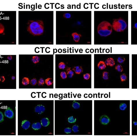 enumeration and examination of ctcs captured by the parsortix platform