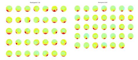 Example Independent Component IC Scalp Maps Download Scientific Diagram