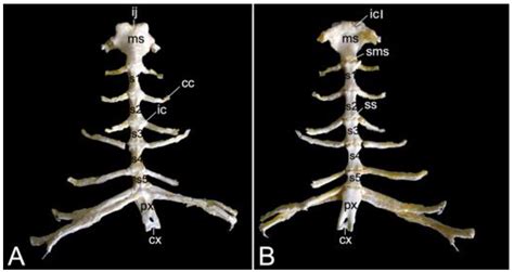 Incisura Jugularis Incisura Jugularis