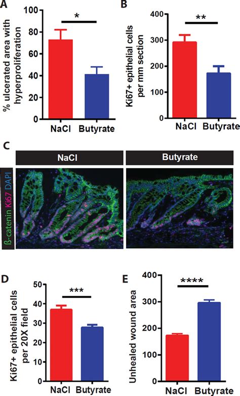 The Colonic Crypt Protects Stem Cells From Microbiota Derived