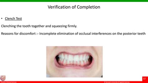 Occlusion In Restorative Dentistry Pptx