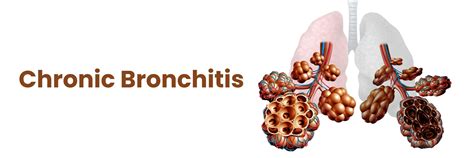Chronic Bronchitis Symptoms And Treatment Guide