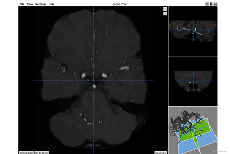 Vtk文件版本转换51到30如何将vtk文件转化为dat文件 Csdn博客
