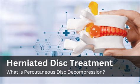 How To Treat A Herniated Disc Percutaneous Disc Decompression