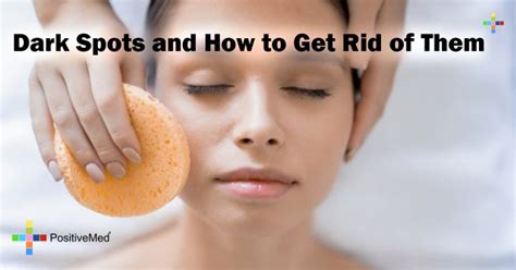 Dark Spots And How To Get Rid Of Them PositiveMed