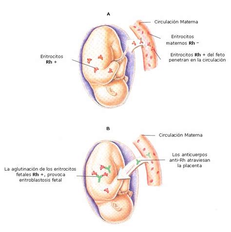 Eritroblastosis Fetal Blog de Biología