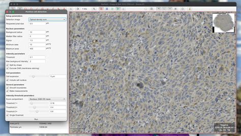 Qupath Positive Cell Detection Parameters Suggestions Image Analysis Imagesc Forum