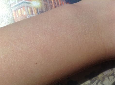 Мелкие красные точки на теле Ответы Mail