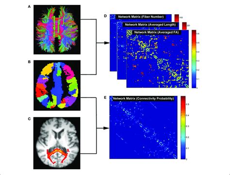 Flowchart For Constructing Anatomical Brain Networks Using Diffusion