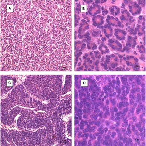 A Mouse Mammary Tumor Virus Mmtv Positive By Polymerase Chain