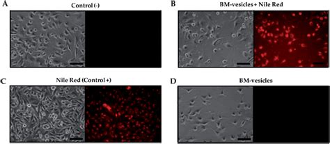 Bm Vesicles Penetration In Cells Phase Contrast Microscopy And