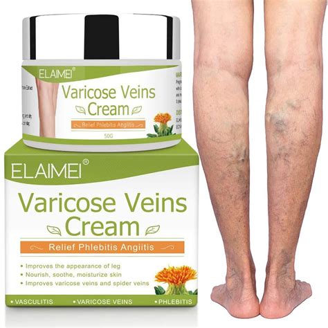 Varicose Veins Cream Varicose Vein Soothing Leg Cream Relief Phlebitis