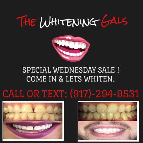 If Your In The Ny Area And Interested In Whitening Your Teeth Let Me Know And Text The Number