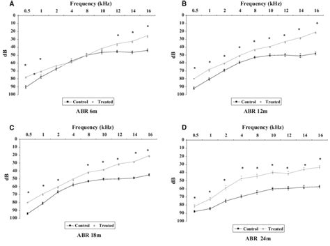 Abr Threshold Shifts In The Control And Treated Group The Abr Download Scientific Diagram