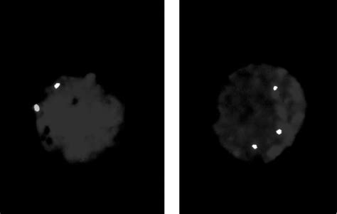 The Use Of Fish With Dna Probes From The X And Y Chromosomes To Sex