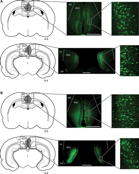 Retrosplenial Cortex Is Required For The Retrieval Of Remote Memory For Auditory Cues