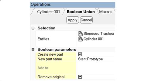Boolean Union Operation To Create The First Approximation Of The Stent