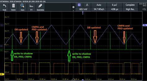 Tms320f280049c Epwm Global Load Problem With Deadtime And Period Load