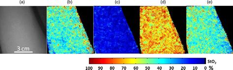 second derivative multispectral algorithm for quantitative assessment