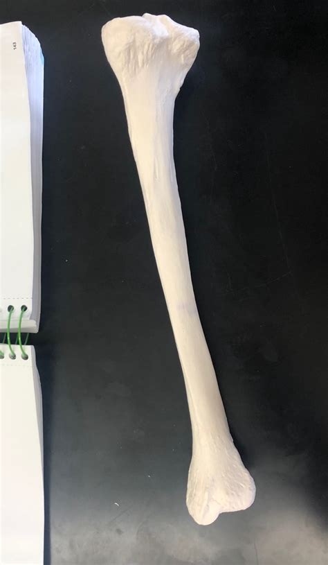 Tibia 1 Right Posterior View Diagram Quizlet
