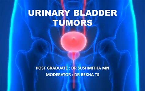 Urinary Bladder Tumorspdf