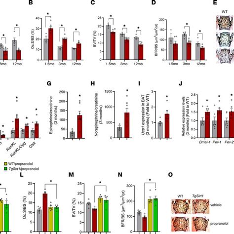 Increased Sympathetic Tone And Decreased Bone Mass In Tgsirt1 Mice A Download Scientific