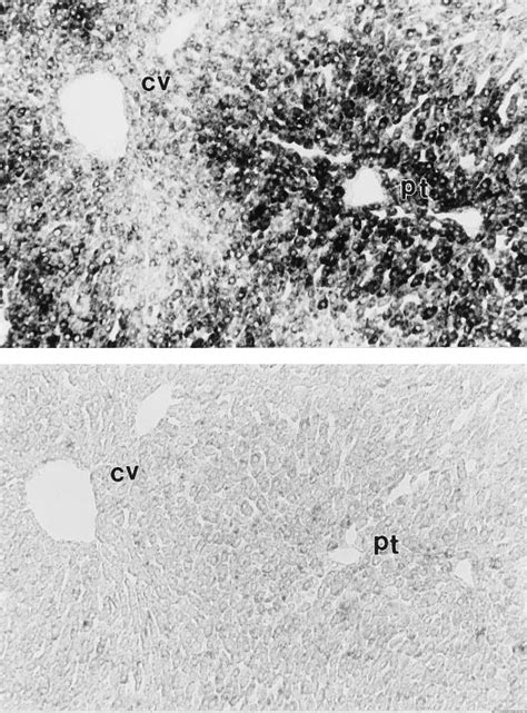 Localization Of Albumin Mrna In Adult Rat Liver Serial Sections Of Download Scientific Diagram
