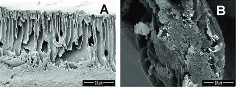 Sem Of A Polysulfone Psu Membrane B Psu Membrane Loaded With F