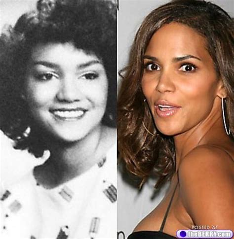 Celebrity Nose Jobs Before And After Bnl