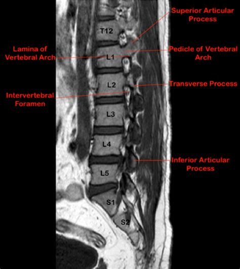 Figure 2 From Guideline To Reporting Of Mri Lumbar Spine Semantic Scholar