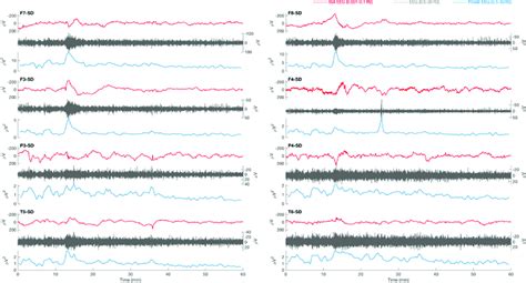 Typical Example Of A 1 H Electroencephalography Eeg Overview From Download Scientific