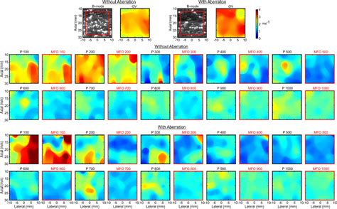 Figure 7 From Feasibility Of Phase Velocity Imaging Using Multi Frequency Oscillation Shear Wave