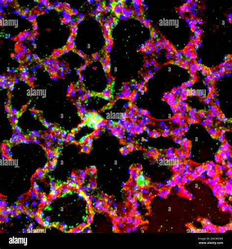 Lung Alveoli Fluorescence Deconvolution Micrograph Of A Section Through Lung Tissue Showing