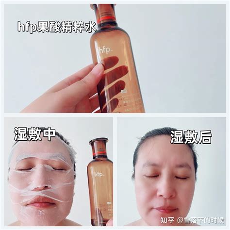 如何拥有一张干净的脸呢？hfp果酸精粹水真能去黑头闭口、控油吗？ 知乎