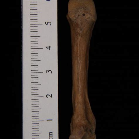Human Left 3rd Metacarpal Dorsal View Boneid