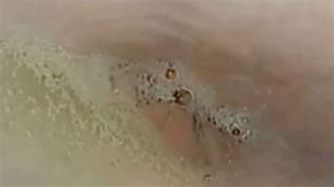 In Loop Inside My Troath With Endoscope Asmr Vore Video Fetish Avi Nicoletta Embassi