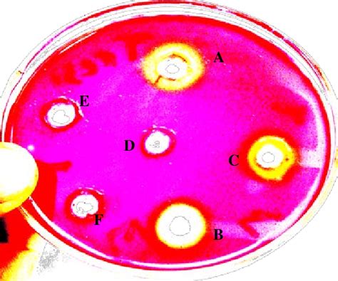 Determination Of Cellulase Activity Produced By Trichoderma Viride Via Download Scientific