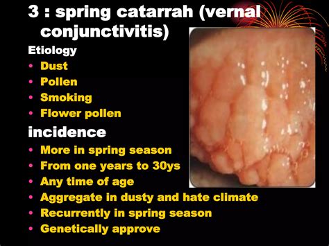 Conjunctival Diseases By Dr Abdul Basir Safi Ppt
