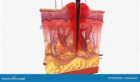 Skin Reaction After Insect Bite Stock Illustration Illustration Of Reaction Inflammatory
