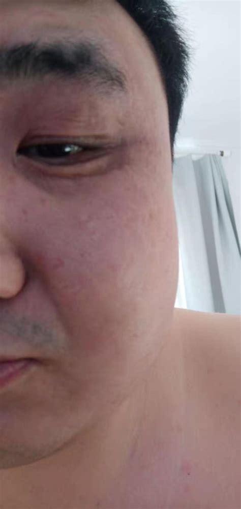 男脸部痣相图解大全男人10处有痣是富贵痣