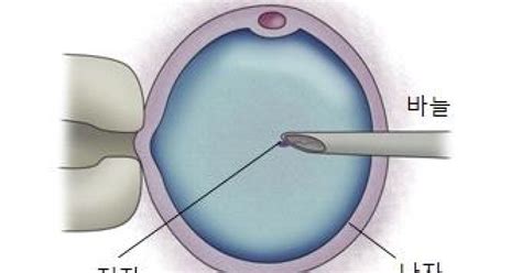 체외수정 신선 배아 냉동 배아 임신 성공률 비슷