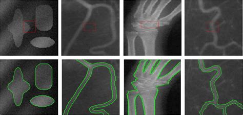 Segmentation Results On Inhomogeneous Images Using The K Glif Model Download Scientific