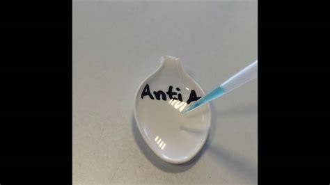 Blodtypebestemmelse Uden Eldonkort Youtube