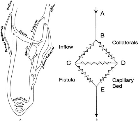 A Basic Components Of An Arteriovenous Fistula Flow In The Artery