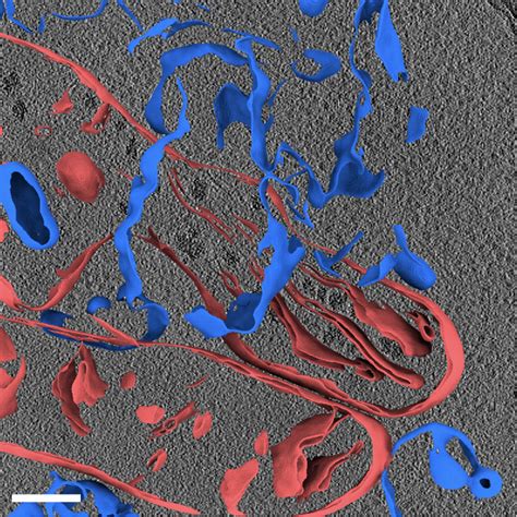 Solving Bottlenecks In CryoET With Machine Learning
