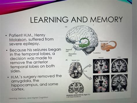 Learning Memory And Higher Cognition Flashcards Quizlet
