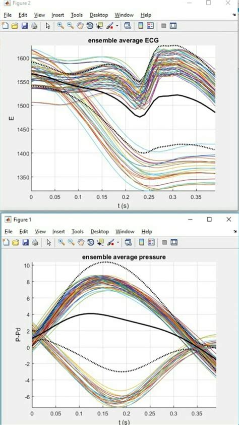 unable to form proper waveform on matlab for ensemble averaging stack