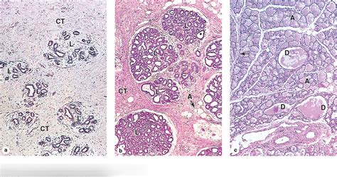 Diagram Of Histology Breast Quizlet