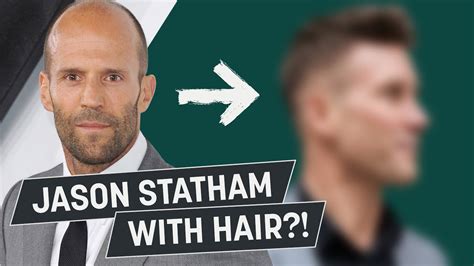 Jason Statham Hair Transplant